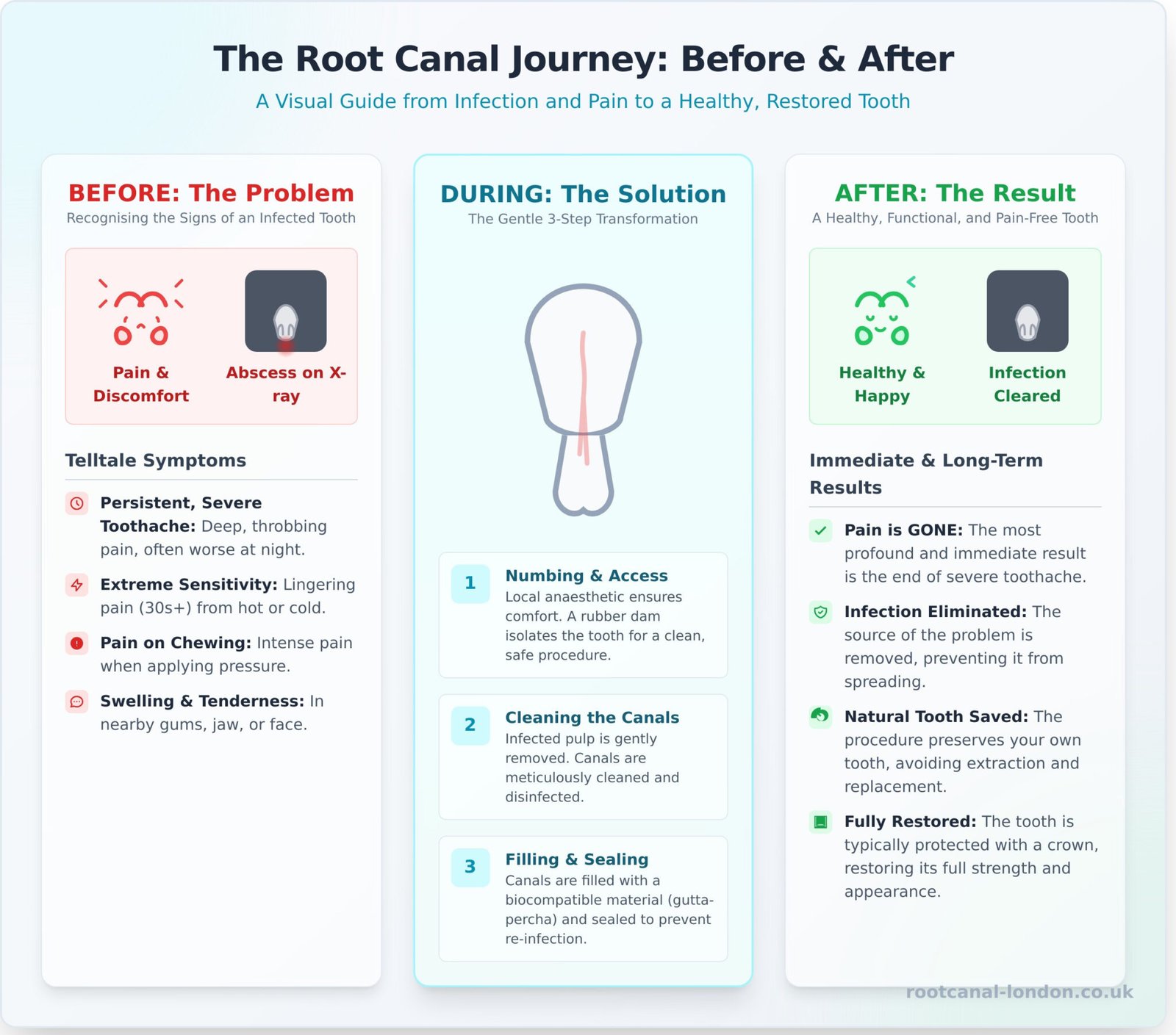 Root Canal Before and After: See the Transformation & Feel the Relief ...