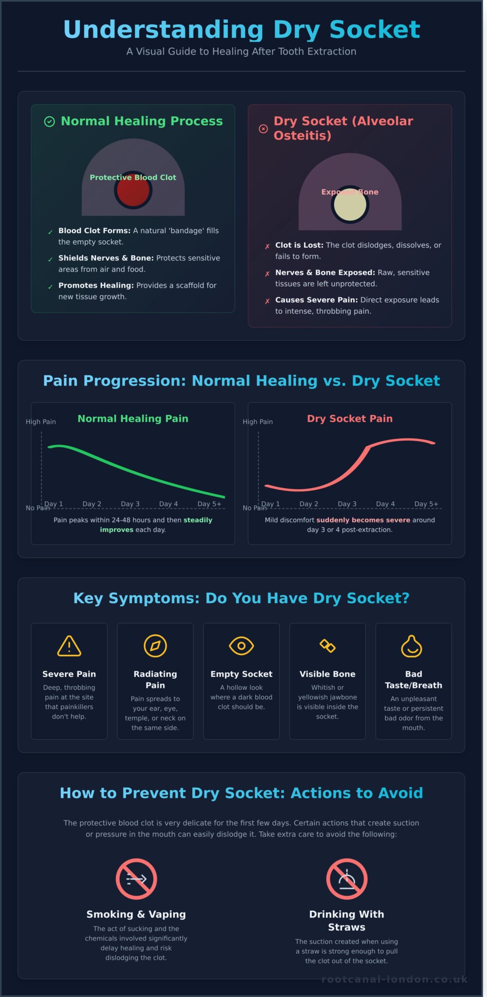 What Is Dry Socket? A Reassuring Guide to Symptoms, Causes, and ...